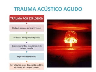 Trauma acustico agudo | PPTX