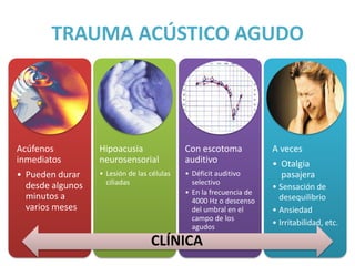Trauma acustico agudo | PPTX