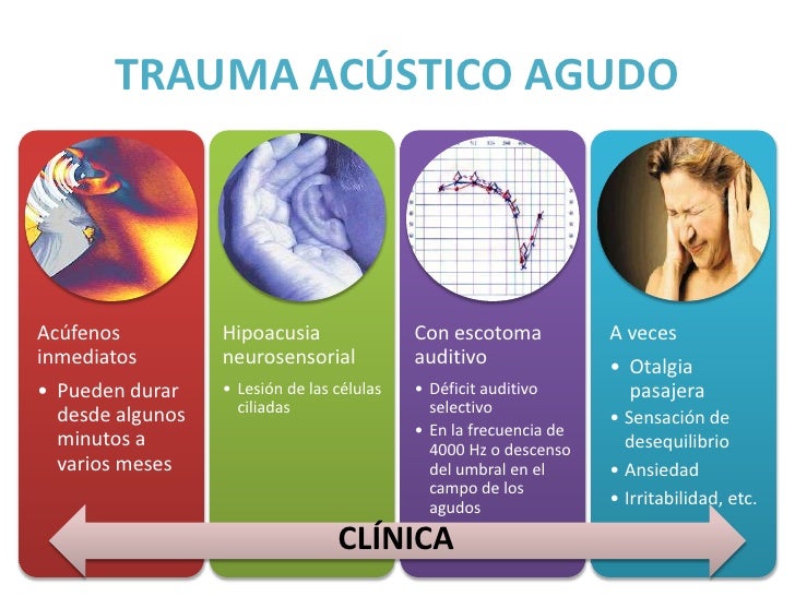 Trauma acustico agudo