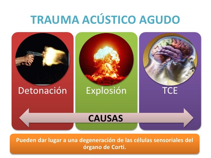 Trauma acustico agudo