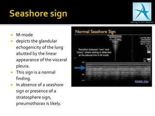 Trauma and critical care | PPTX