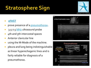 Trauma and critical care | PPTX