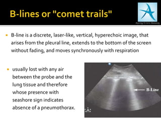 Trauma and critical care | PPTX