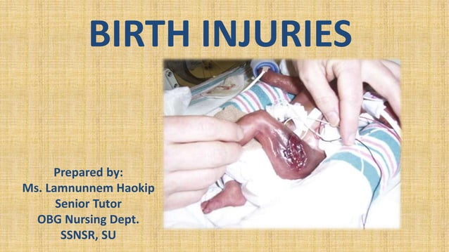 Birth Injuries | PPT