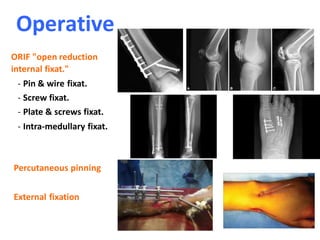 Trauma approach | PPTX