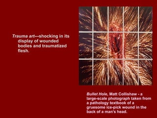 Trauma art extended | PPT