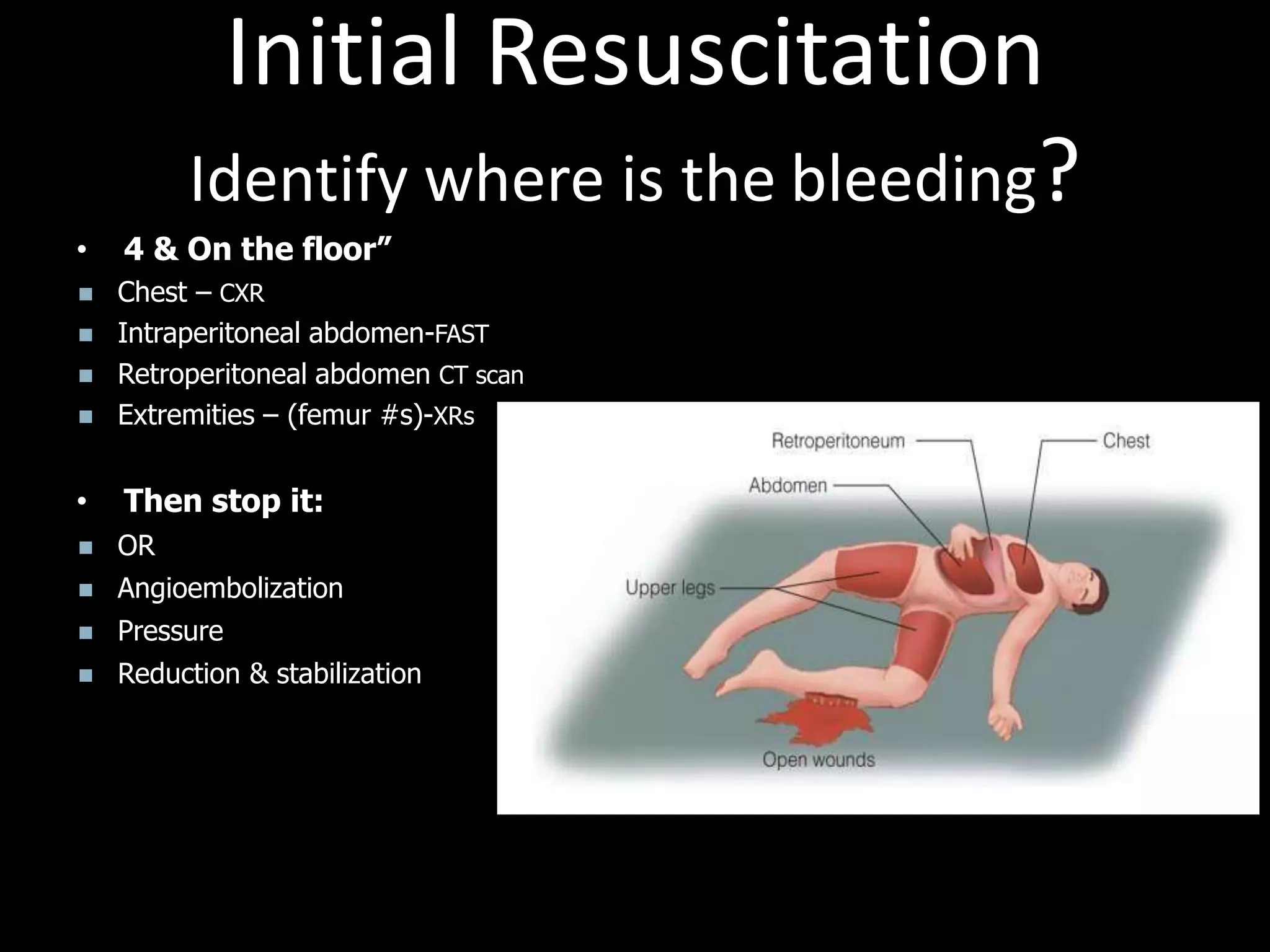 MANAGEMENT OF ABDOMINAL TRAUMA | PPTX
