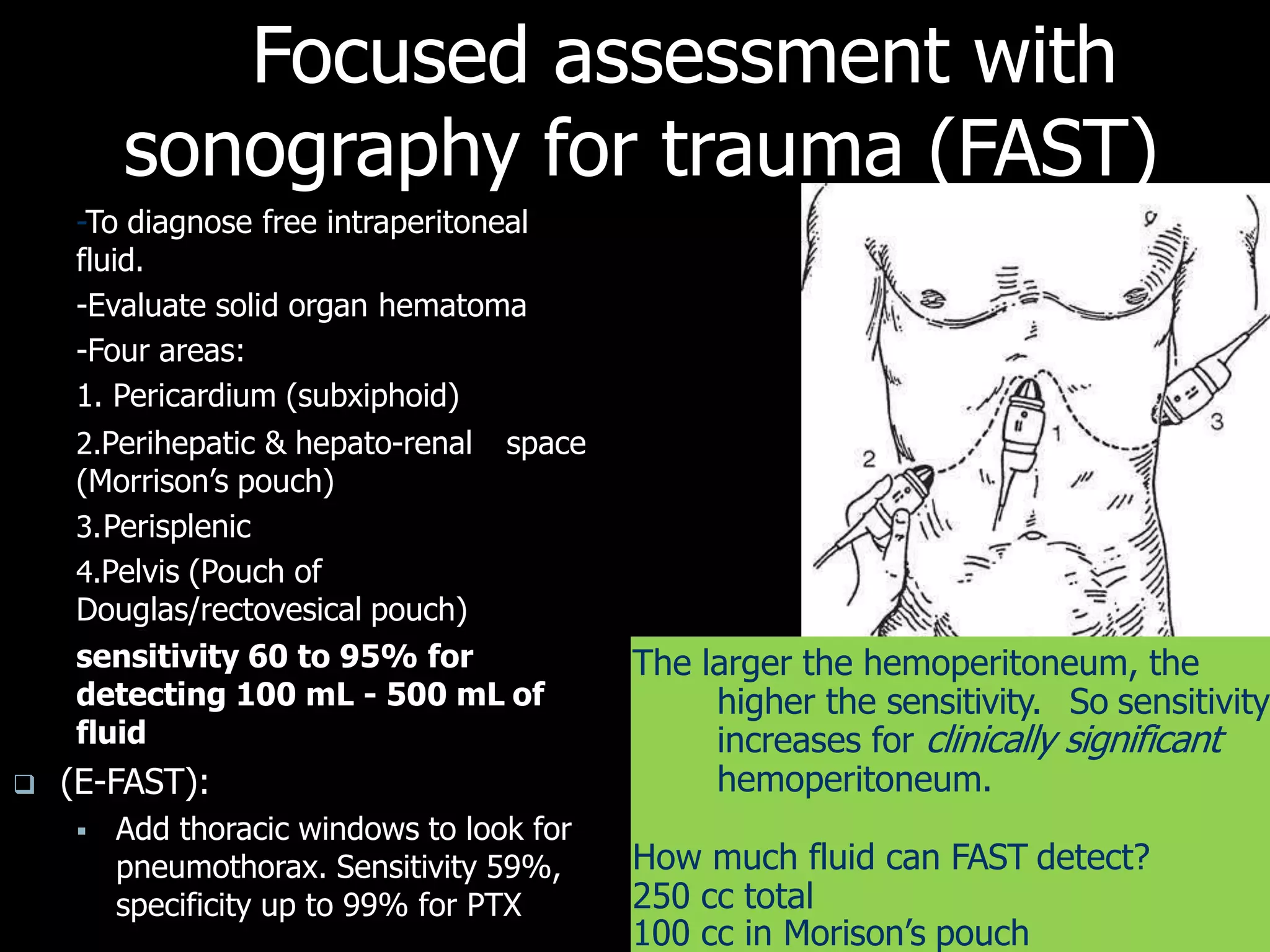 MANAGEMENT OF ABDOMINAL TRAUMA | PPTX