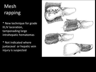 MANAGEMENT OF ABDOMINAL TRAUMA | PPTX