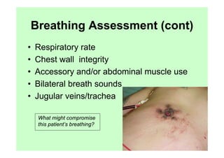 Trauma Assessment | PDF