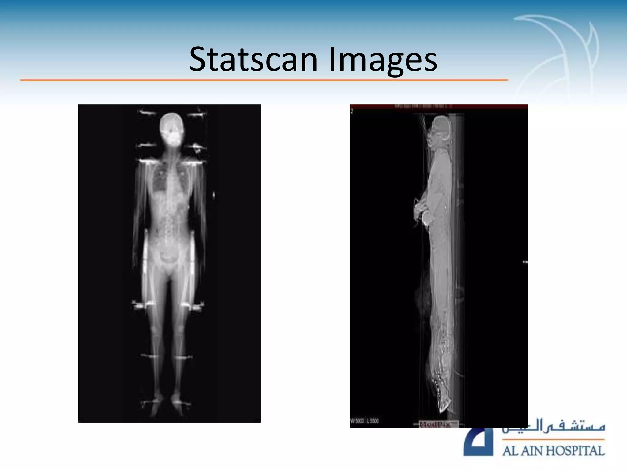 Trauma audit presentation | PPTX