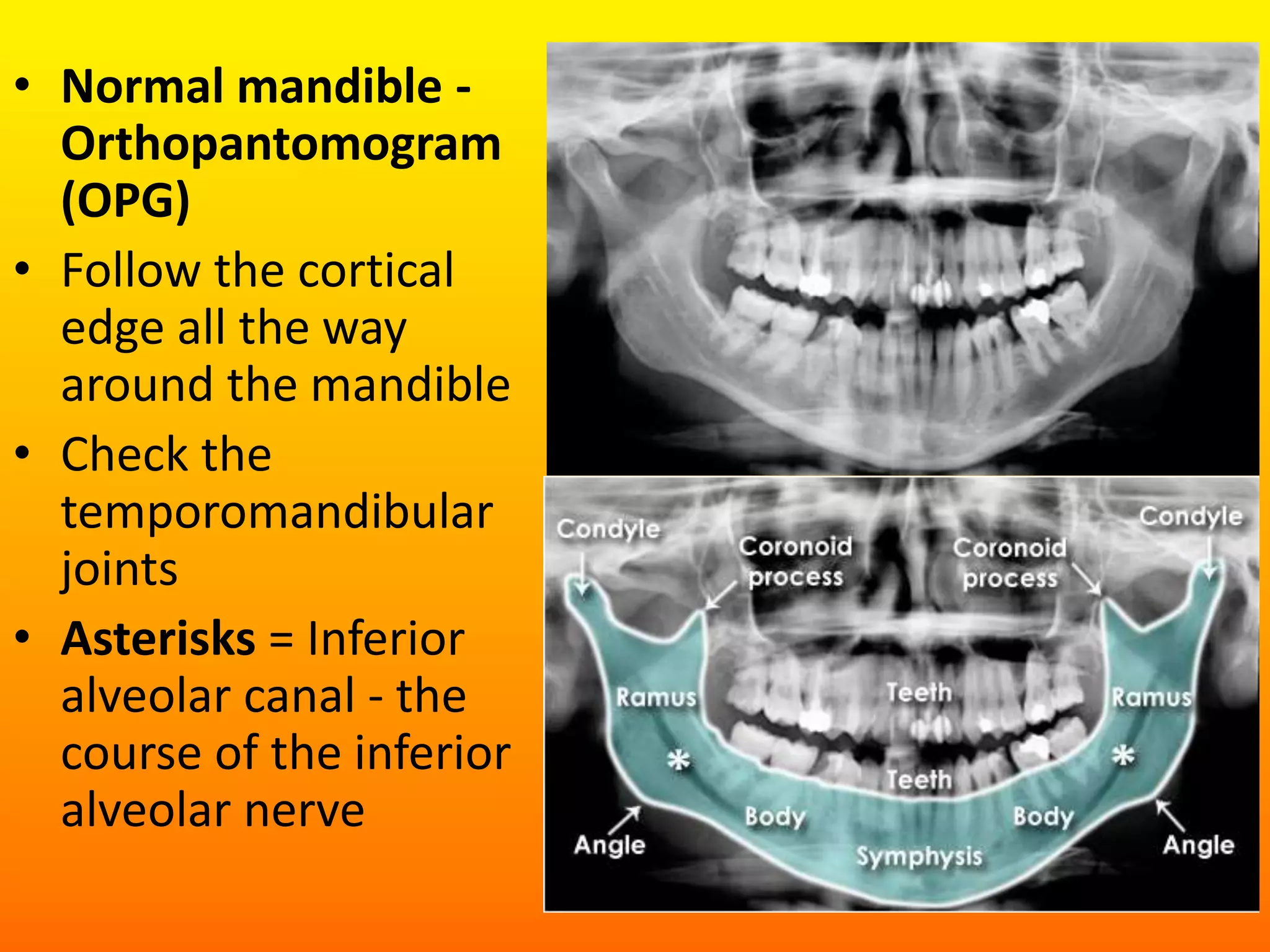 Trauma axial skeleton Dr. Muhammad Bin Zulfiqar | PPTX