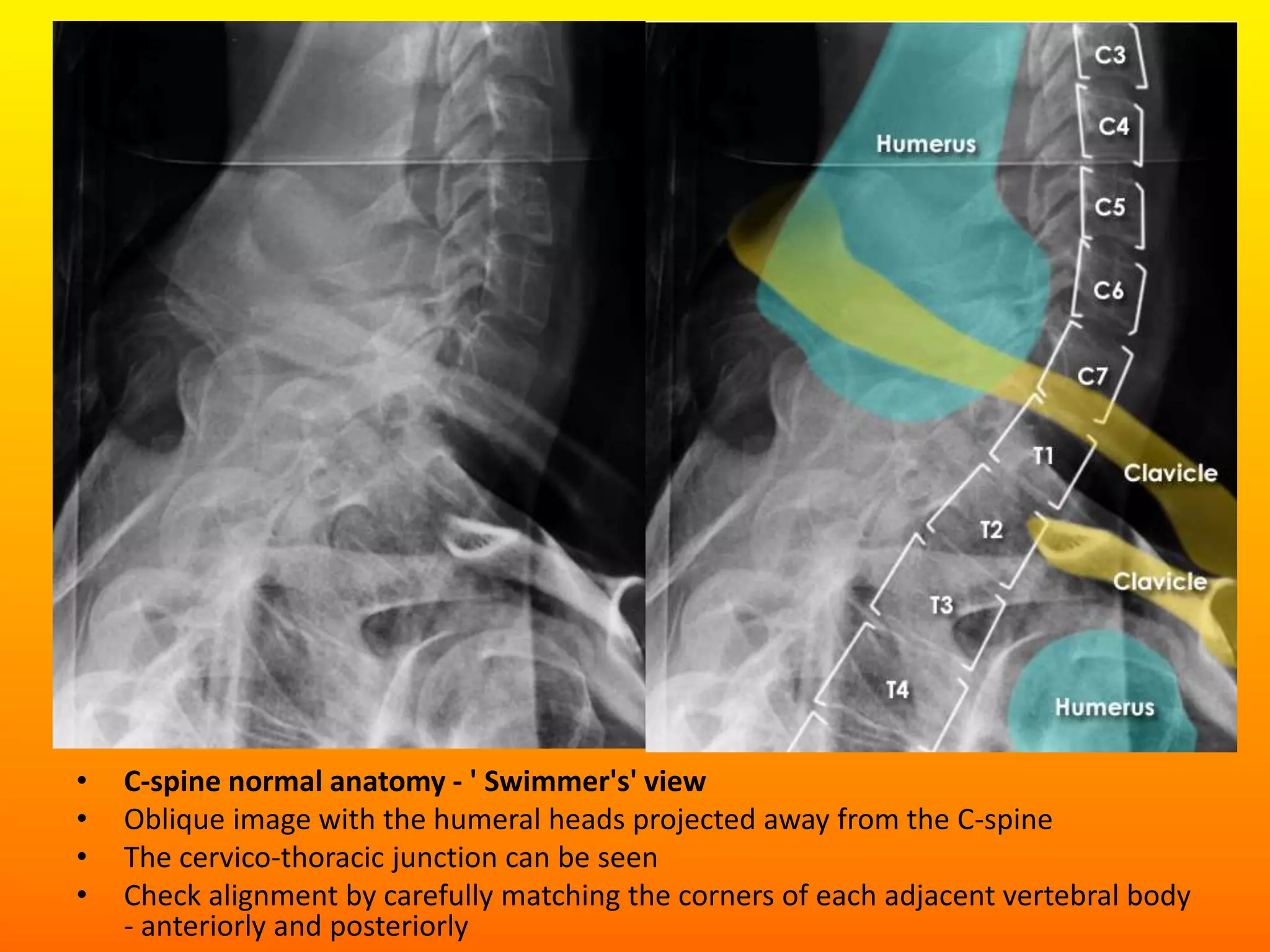 Trauma axial skeleton Dr. Muhammad Bin Zulfiqar | PPTX