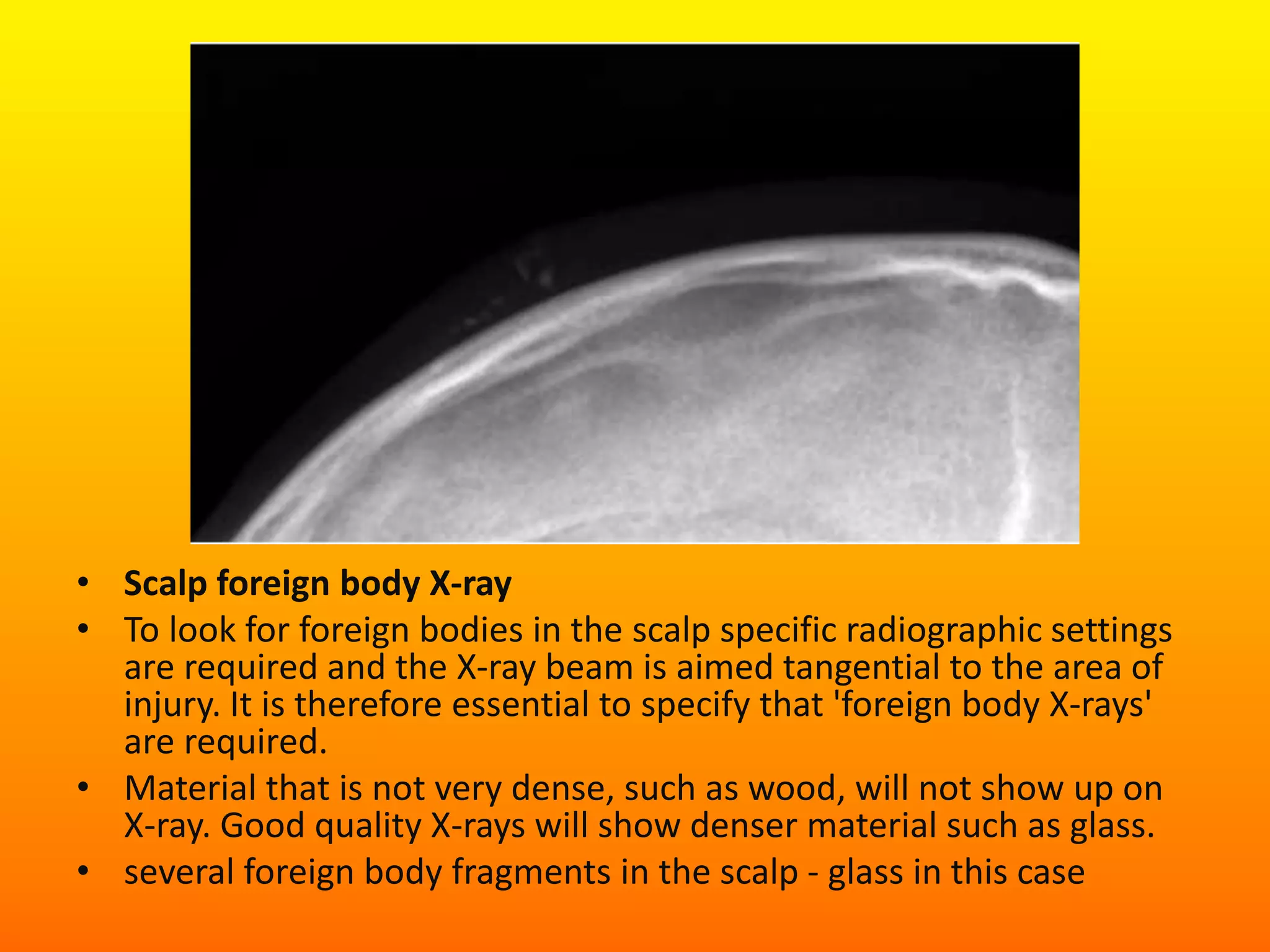 Trauma axial skeleton Dr. Muhammad Bin Zulfiqar | PPTX