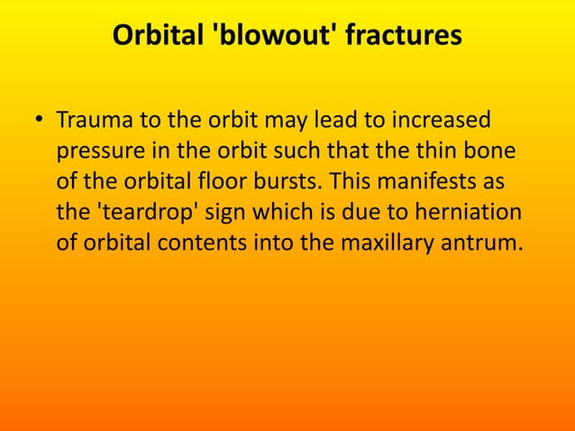 Trauma axial skeleton Dr. Muhammad Bin Zulfiqar | PPT