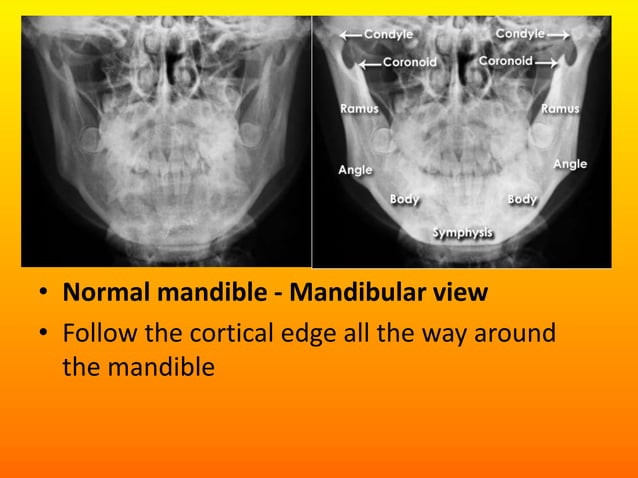 Trauma axial skeleton Dr. Muhammad Bin Zulfiqar | PPT