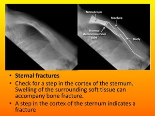 Trauma axial skeleton Dr. Muhammad Bin Zulfiqar | PPTX