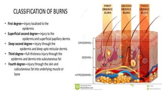 Trauma,Burns.pptx