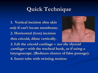 Trauma Case 4.ppt