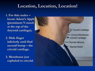 Trauma Case 4.ppt
