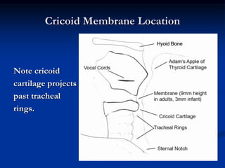 Trauma Case 4.ppt