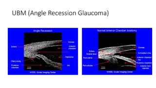 Ahmed Osama Hashem ophthalmology Trauma clinical slides | PPT