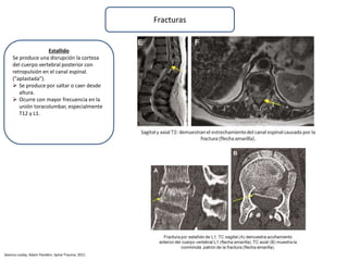 Trauma columna | PPTX
