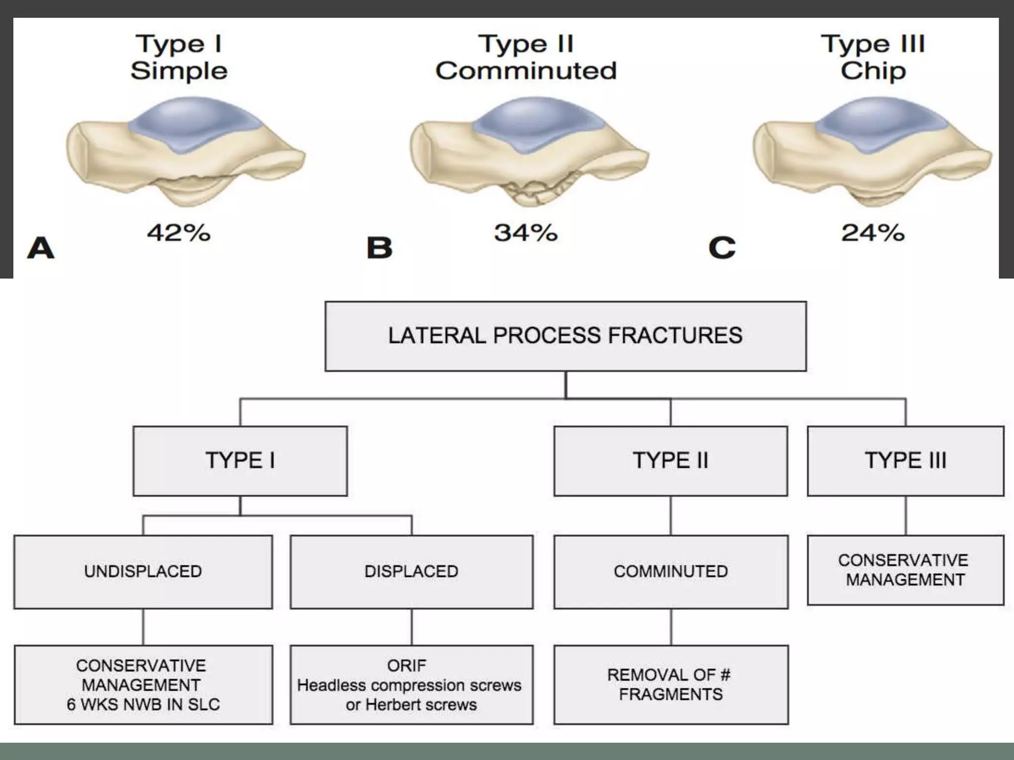 TRAUMA CON-TALAR FRACTURES.pptx