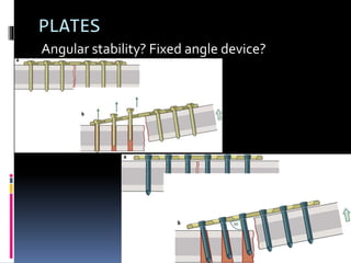 Trauma concepts and fixations | PPTX