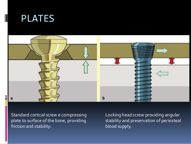 Trauma concepts and fixations