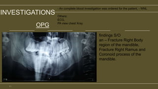 case presentation.pptx