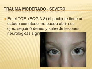 Trauma craneoencefalico pediatricos | PPTX