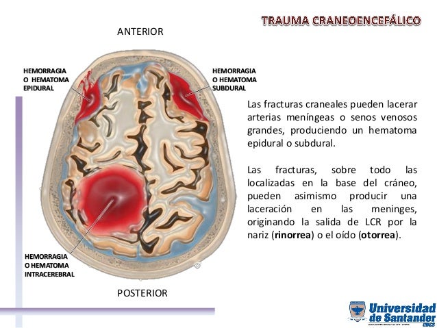 Traumatismo Cranioencefálico: Como Classificar? – CJCP