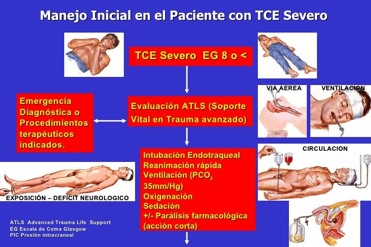 Trauma craneoencefálico
