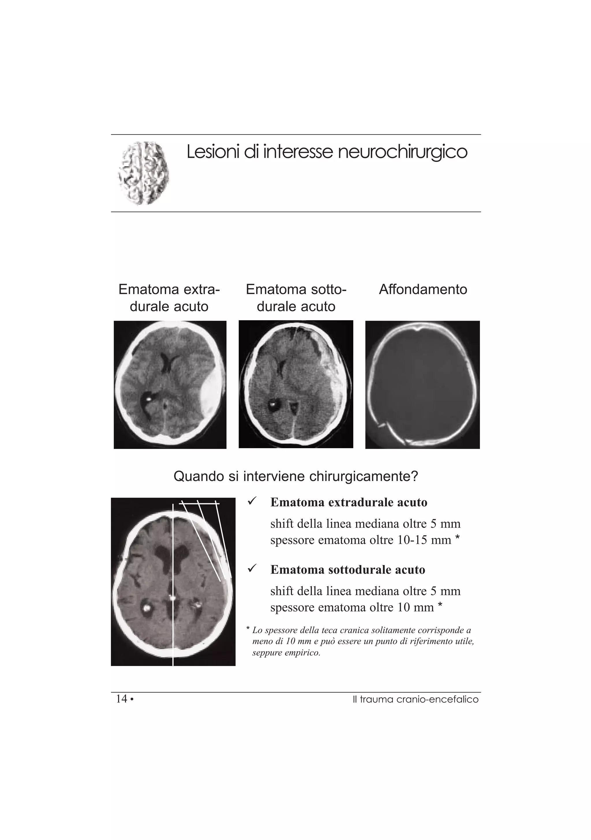 Linee guida per la gestione del trauma cranio-encefalico | PDF