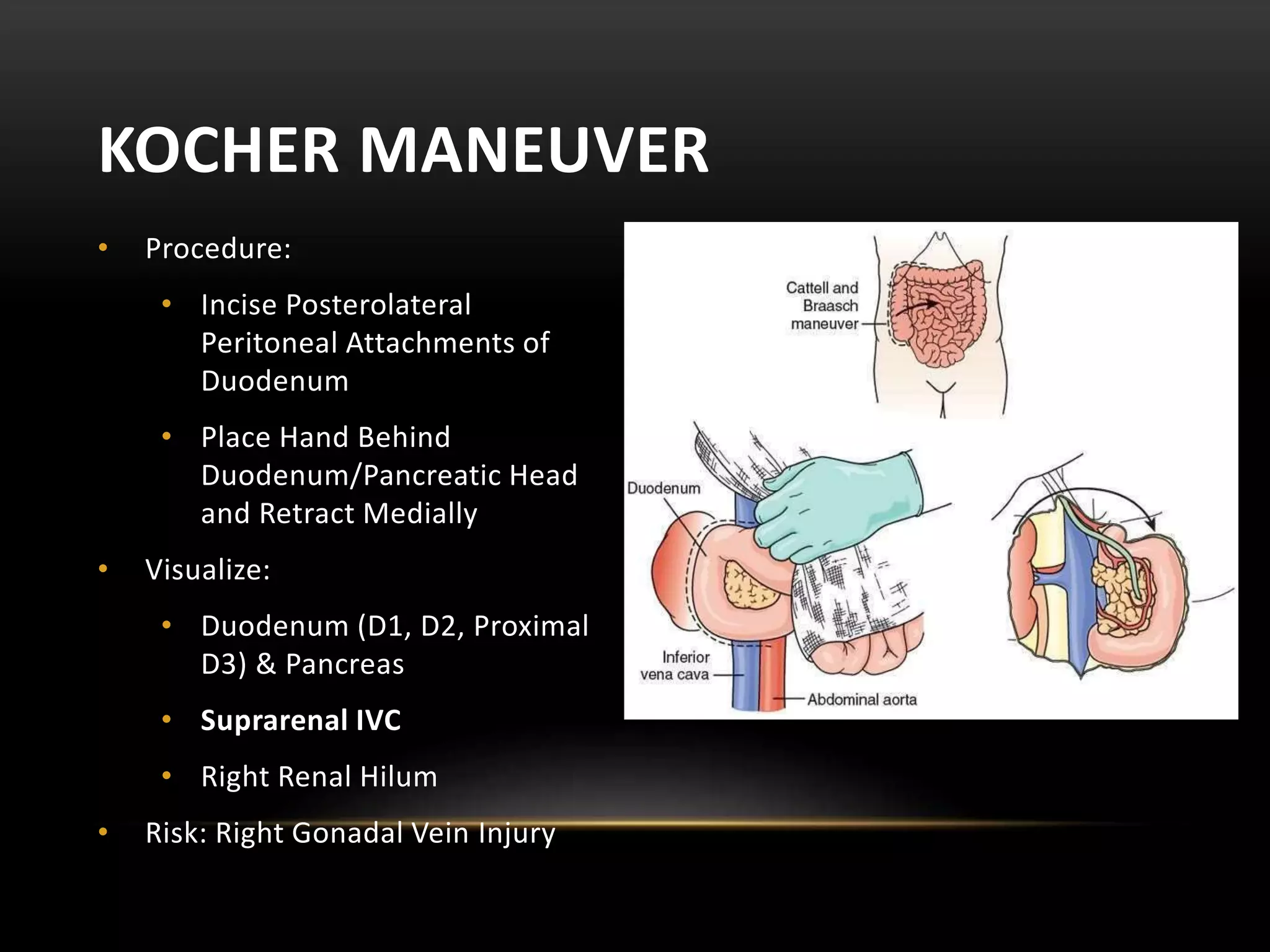 Trauma Crash Laparotomy.pptx