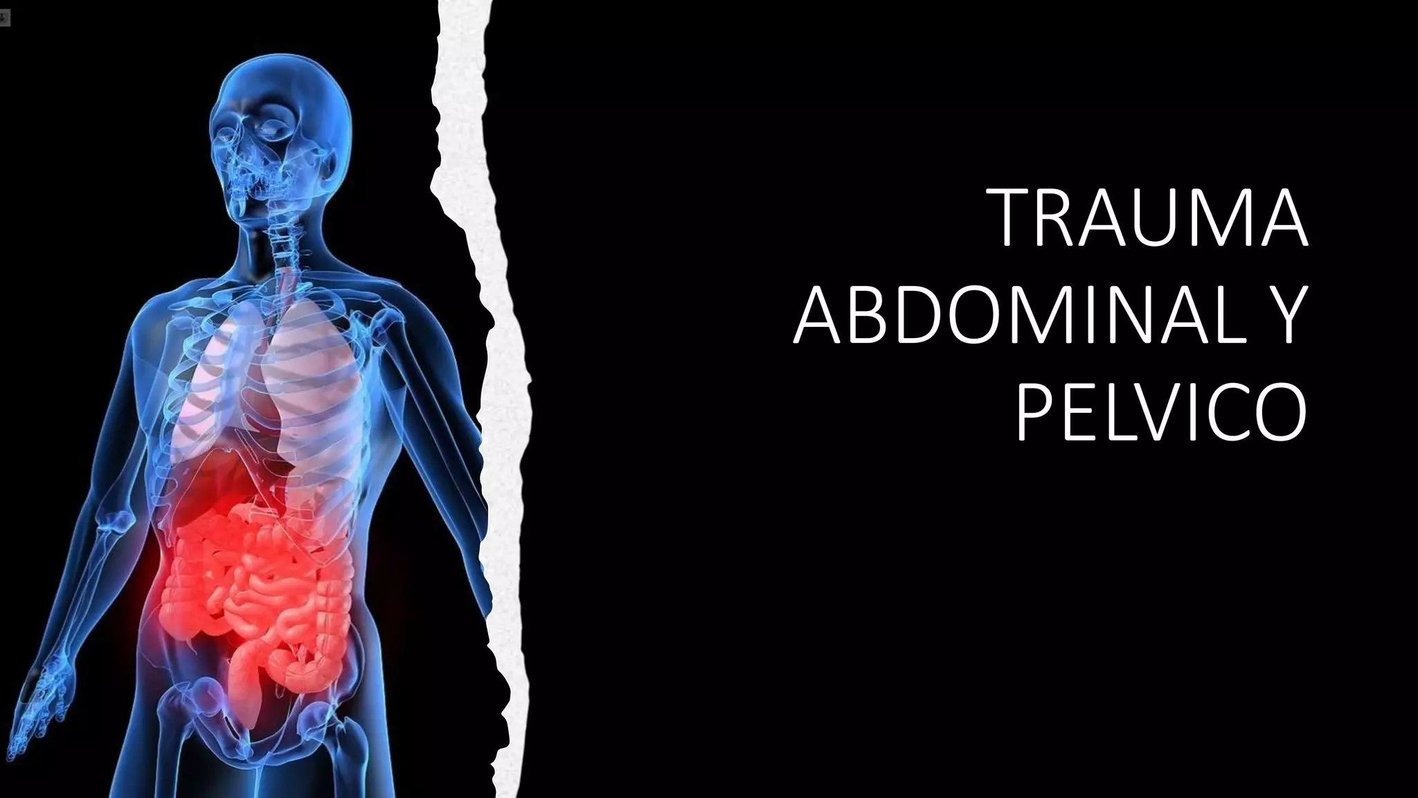 TRAUMA DE ABDOMEN Y PELVIS .pptx