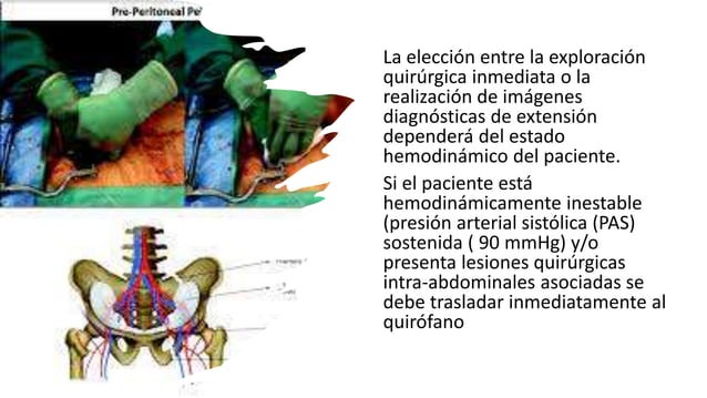 TRAUMA DE ABDOMEN Y PELVIS .pptx