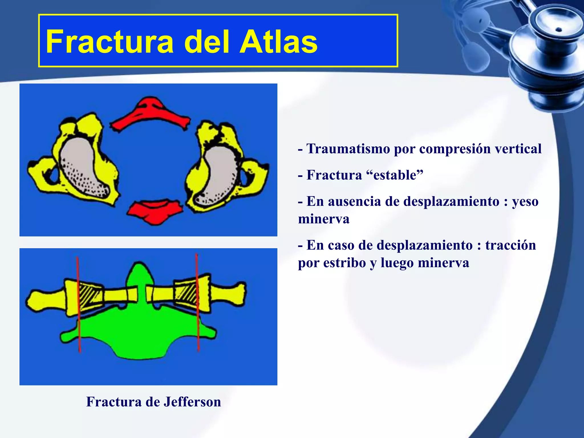 TRAUMA DE COLUMNA CERVICAL.ppt