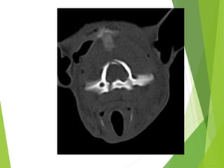Trauma de columna y medula espinal ATLS | PPTX