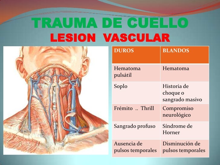 Trauma De Cuello