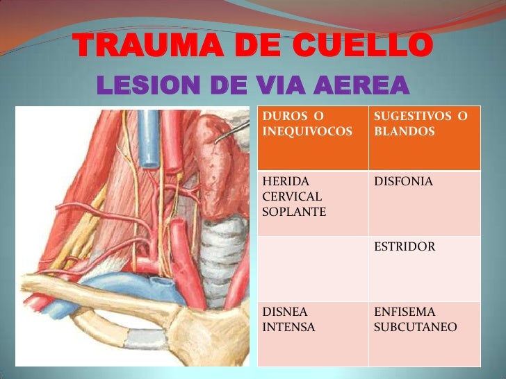 Trauma De Cuello