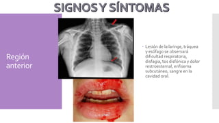 Trauma de cuello | PPTX
