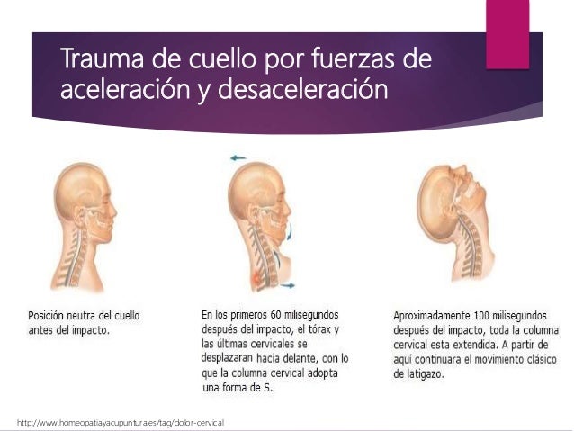 Trauma de cuello
