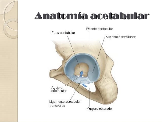 Trauma de femur