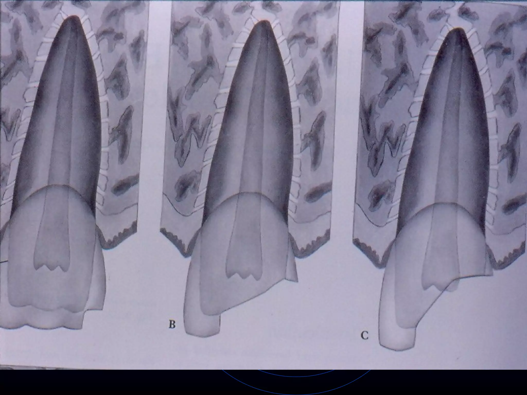 Trauma dentoalveolar | PPT
