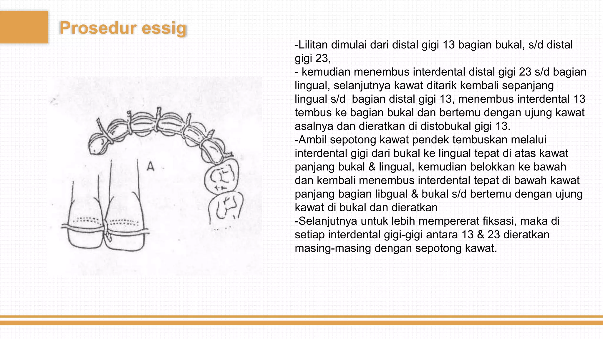 Trauma dentoalveolar | PPTX