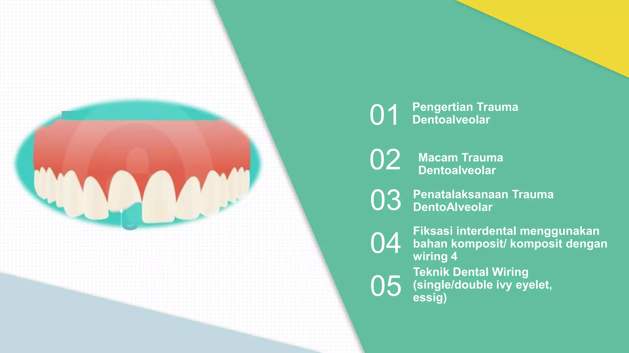 Trauma dentoalveolar | PPTX