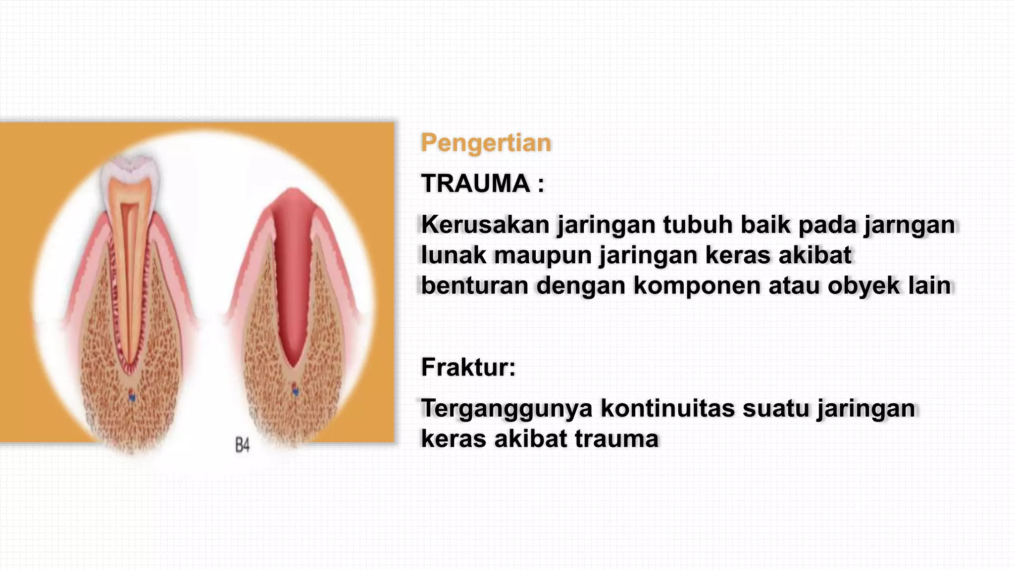 Trauma dentoalveolar | PPTX