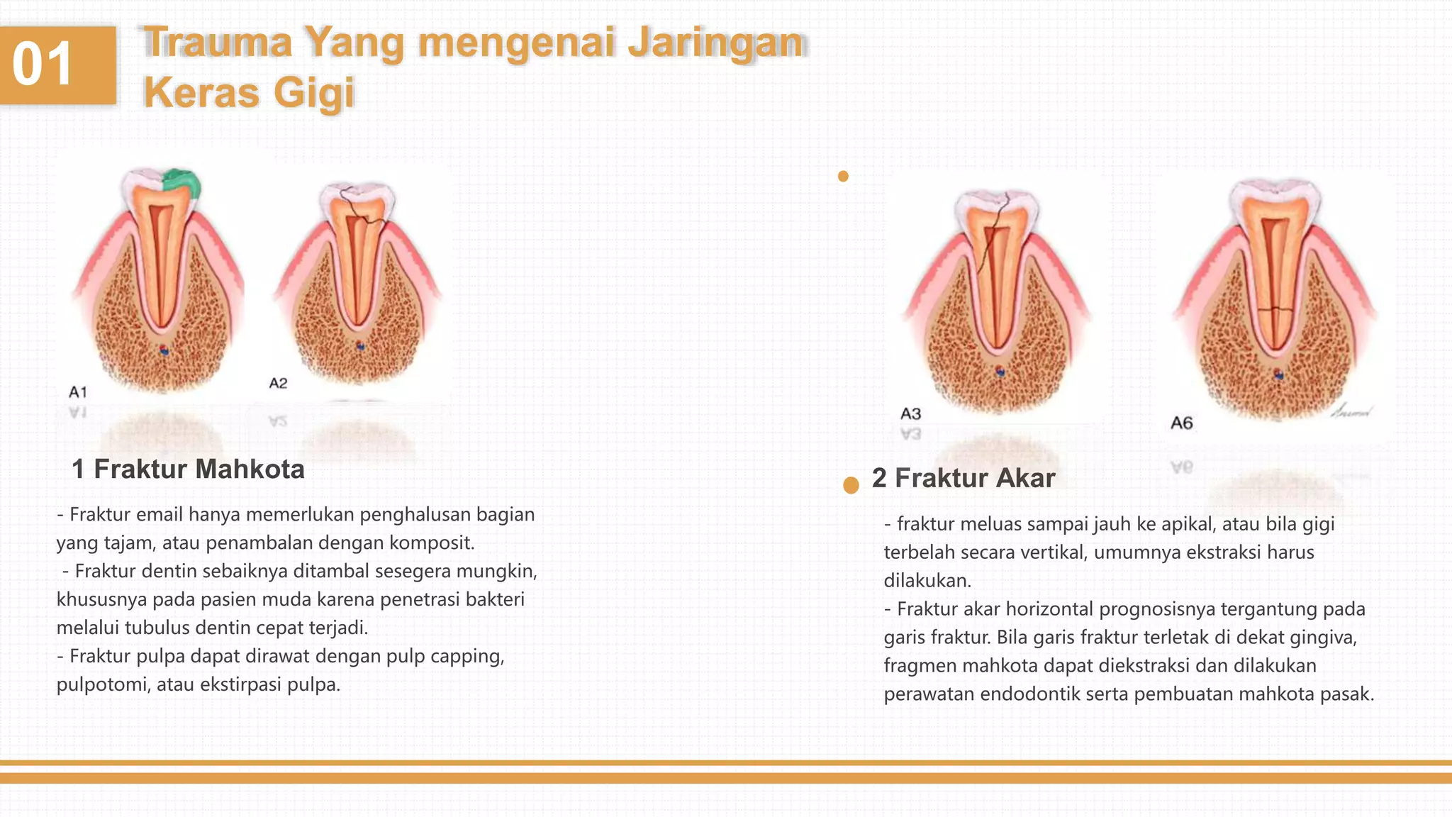 Trauma dentoalveolar | PPTX